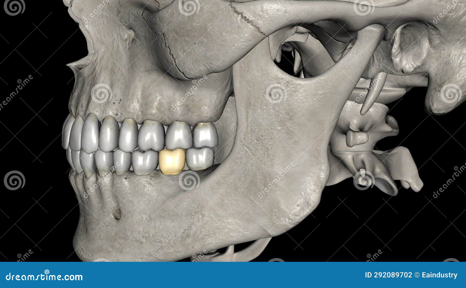 The Mandibular Second Molar is the Tooth Located Distally from Both the ...