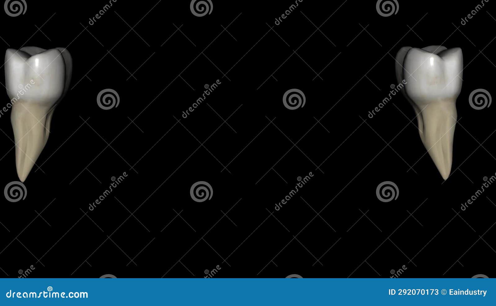 The Mandibular Third Molar is Also Referred As the Wisdom Tooth Stock ...