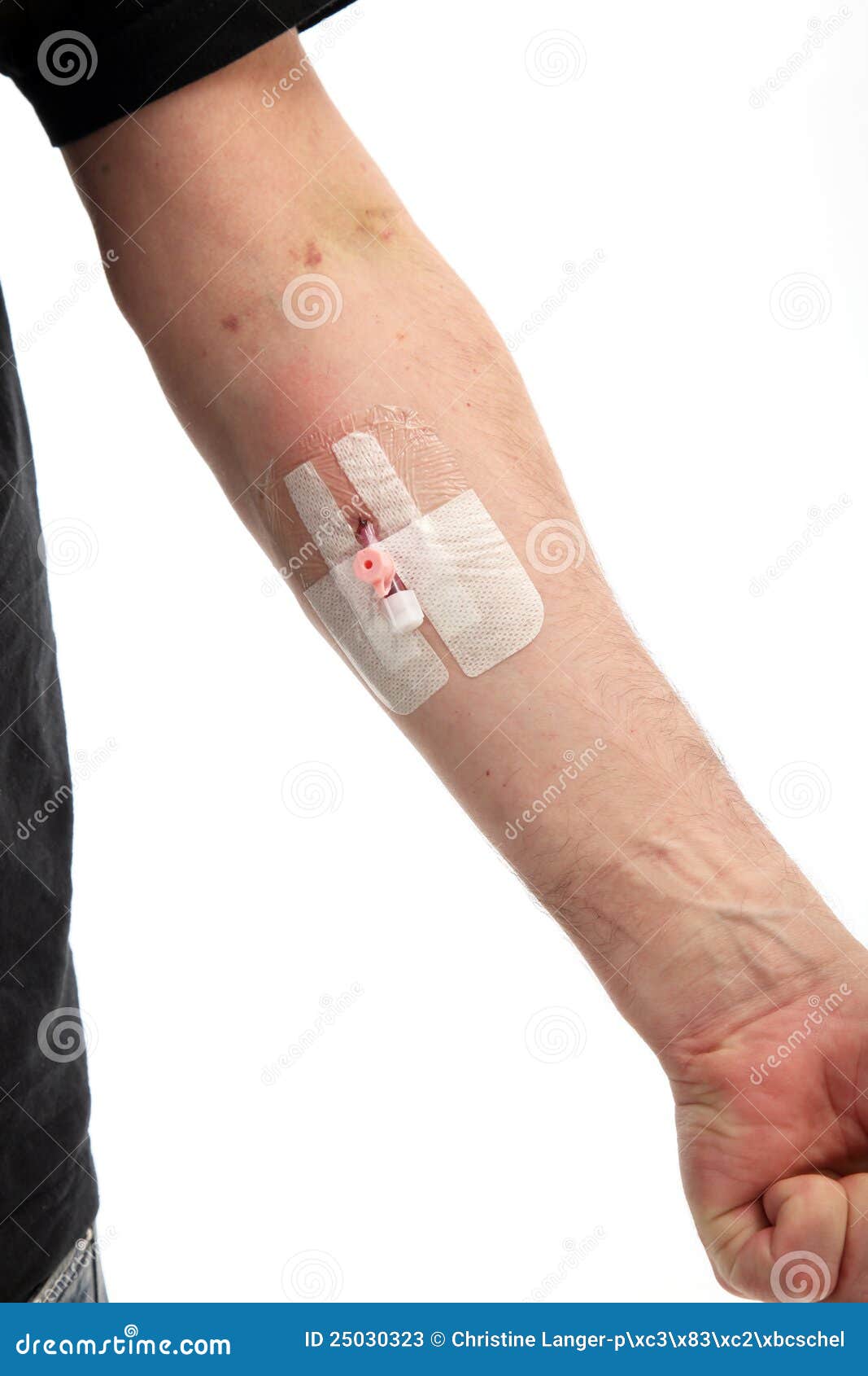 Mann Mit Der Nadel Eingesteckt in Eine Ader Stockbild - Bild von ...