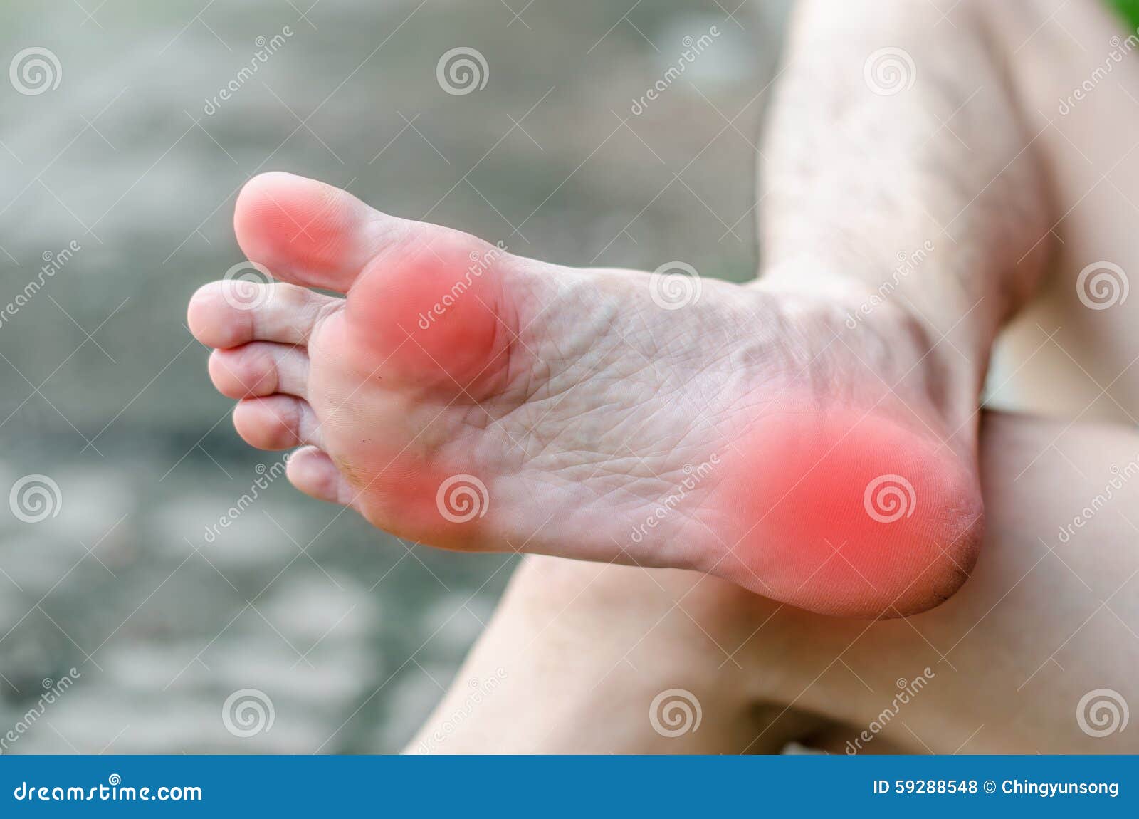 Mannelijke Voetpijn, Man Probleemconcept Stock Foto - Image of lichaam ...