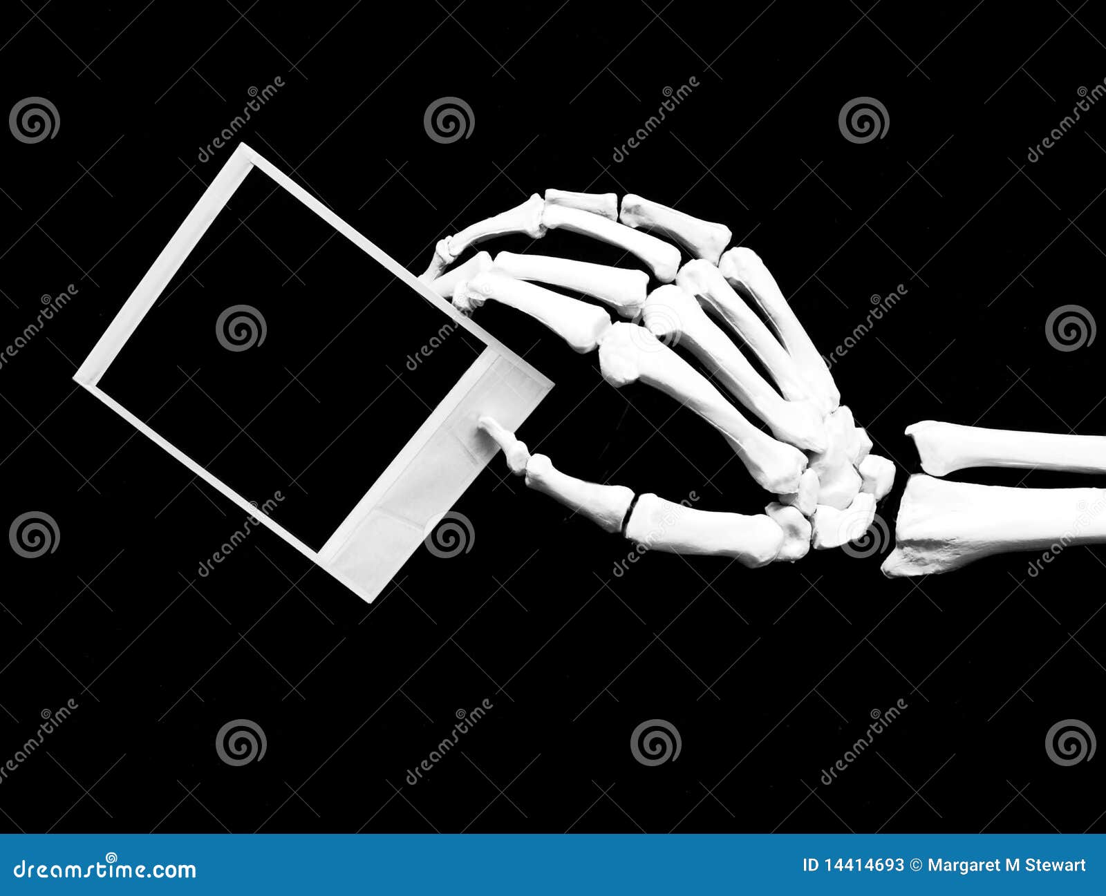 Mano Di Scheletro Con L'immagine Immagine Stock - Immagine di contrasto ...