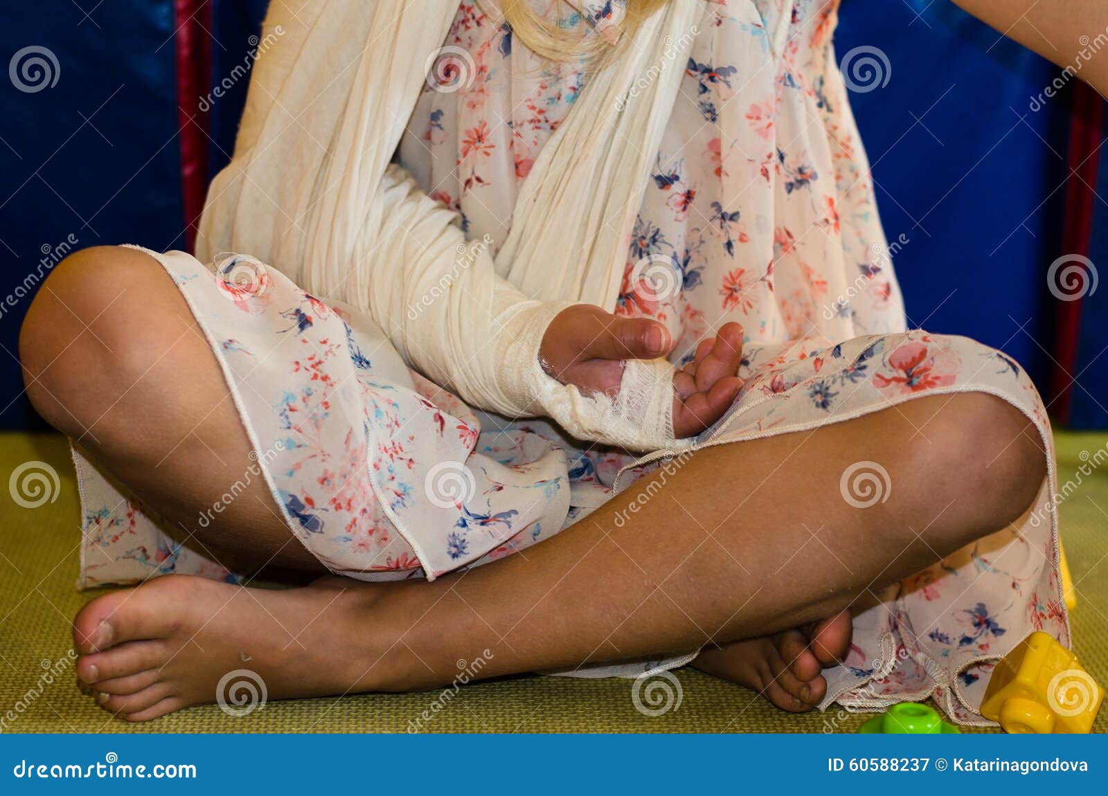 Mano quebrada imagen de archivo. Imagen de hueso, accidente - 60588237