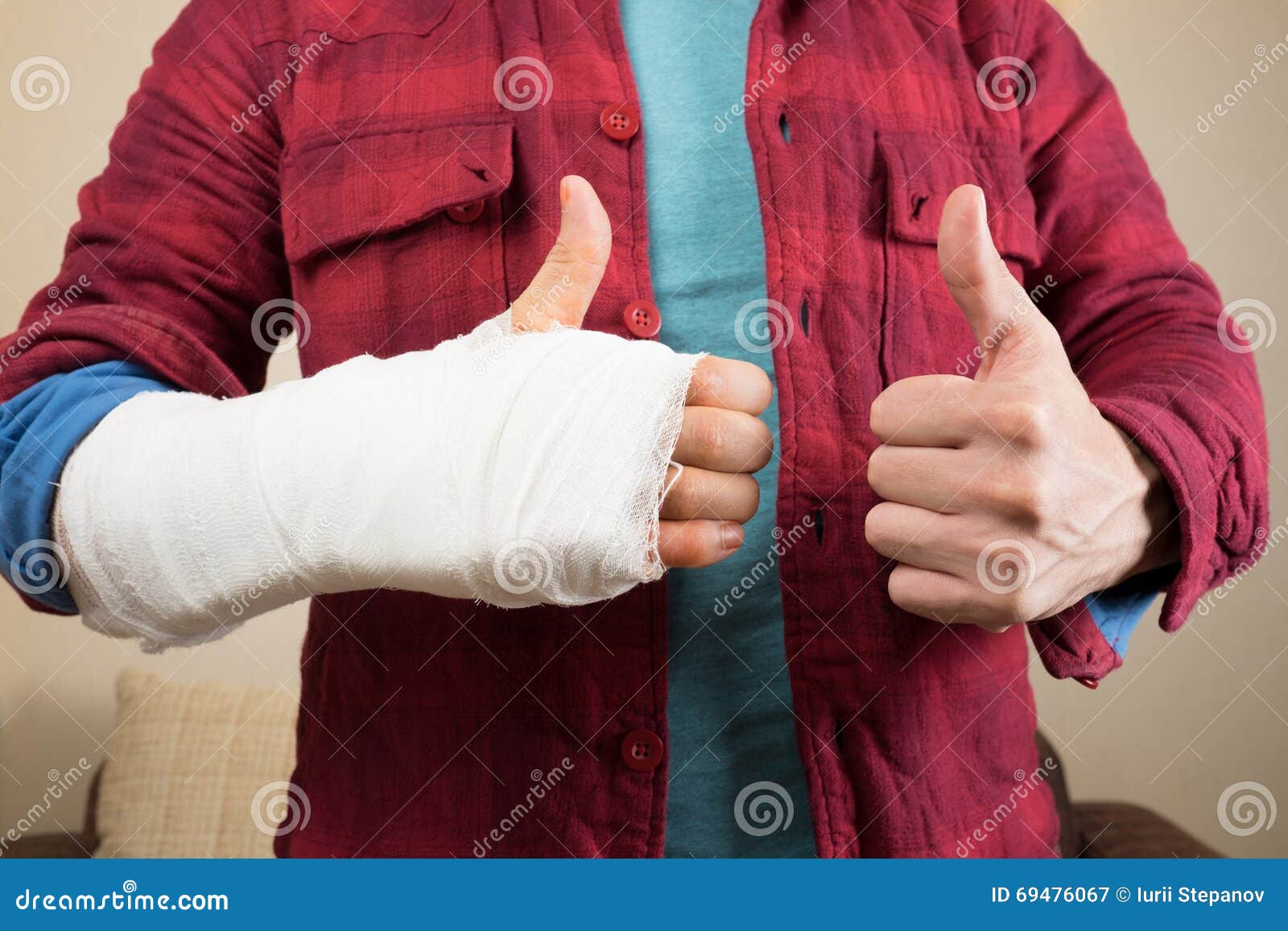 Mano quebrada imagen de archivo. Imagen de humano, espacio - 69476067