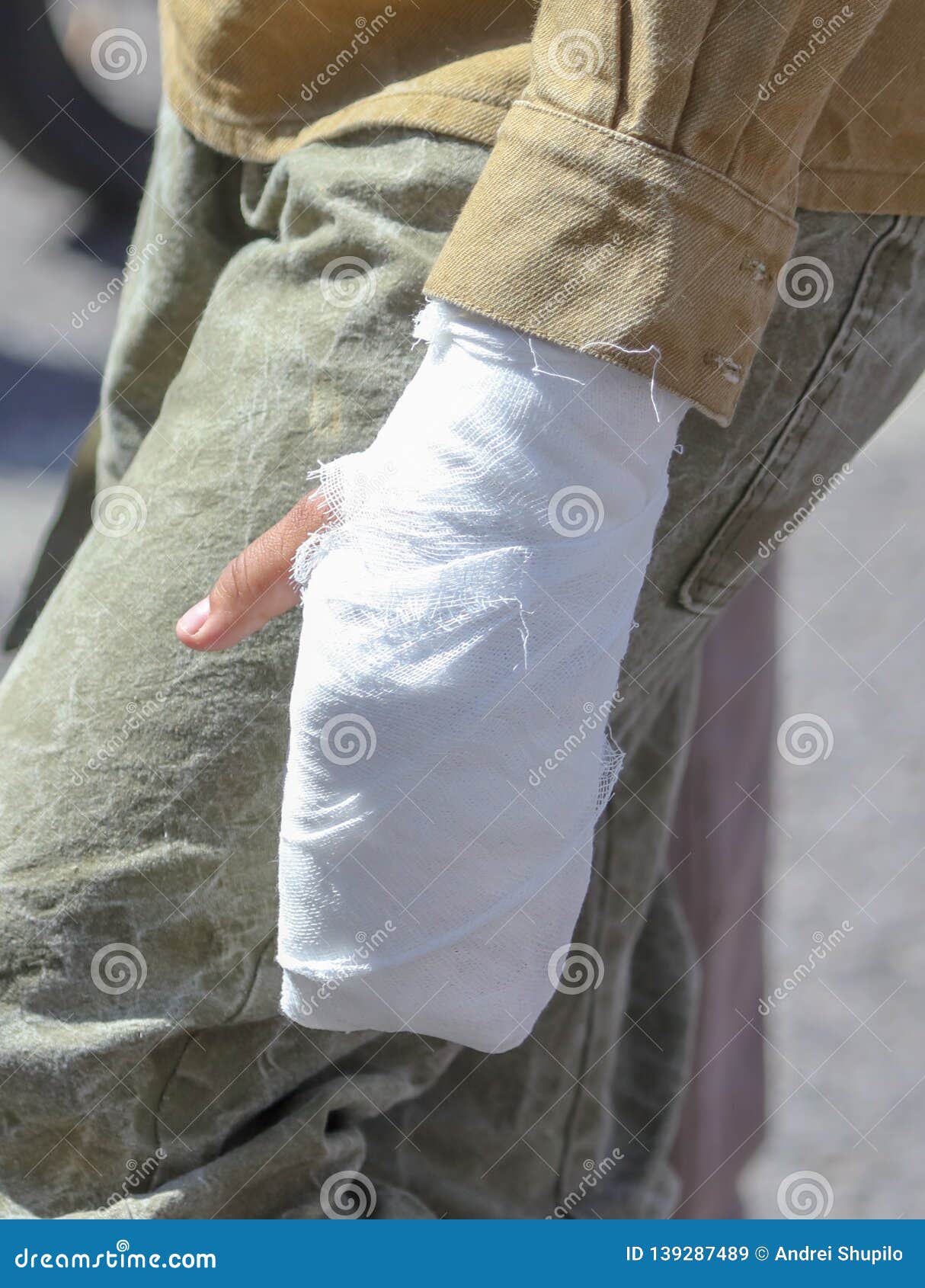 Mano Quebrada En Un Yeso En Un Muchacho Imagen de archivo - Imagen de ...