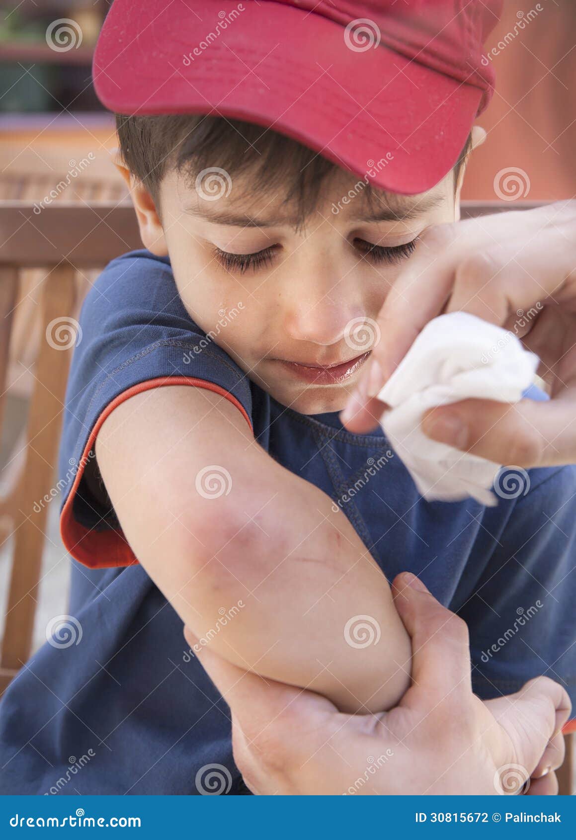 Mano raspada foto de archivo. Imagen de ayuda, cara, mirando - 30815672