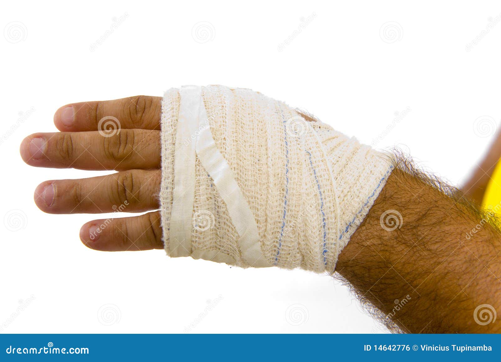 Mano vendada foto de archivo. Imagen de emergencia, salud - 14642776