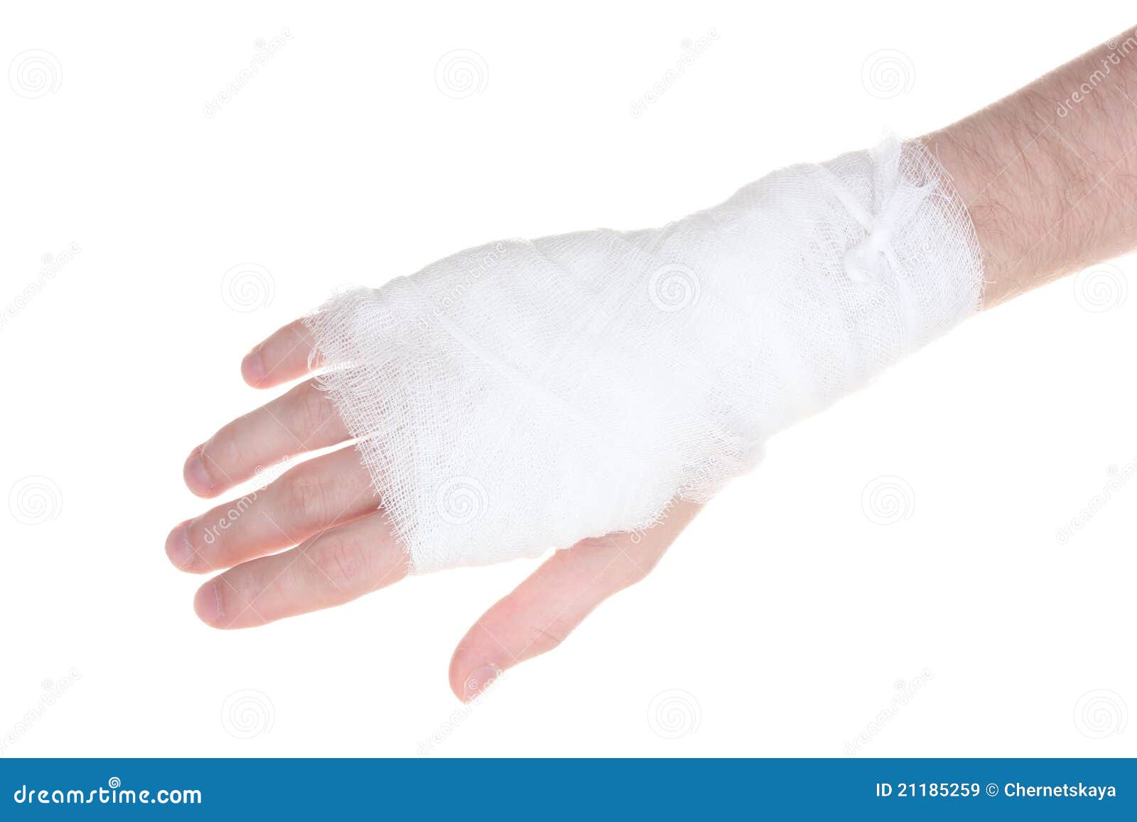 Mano vendada imagen de archivo. Imagen de brazo, salud - 21185259