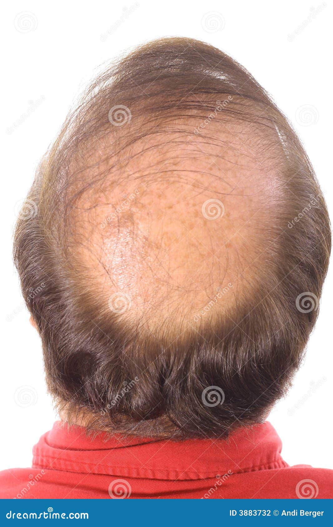 Mans bald head upclose stock photo. Image of hair, male - 3883732