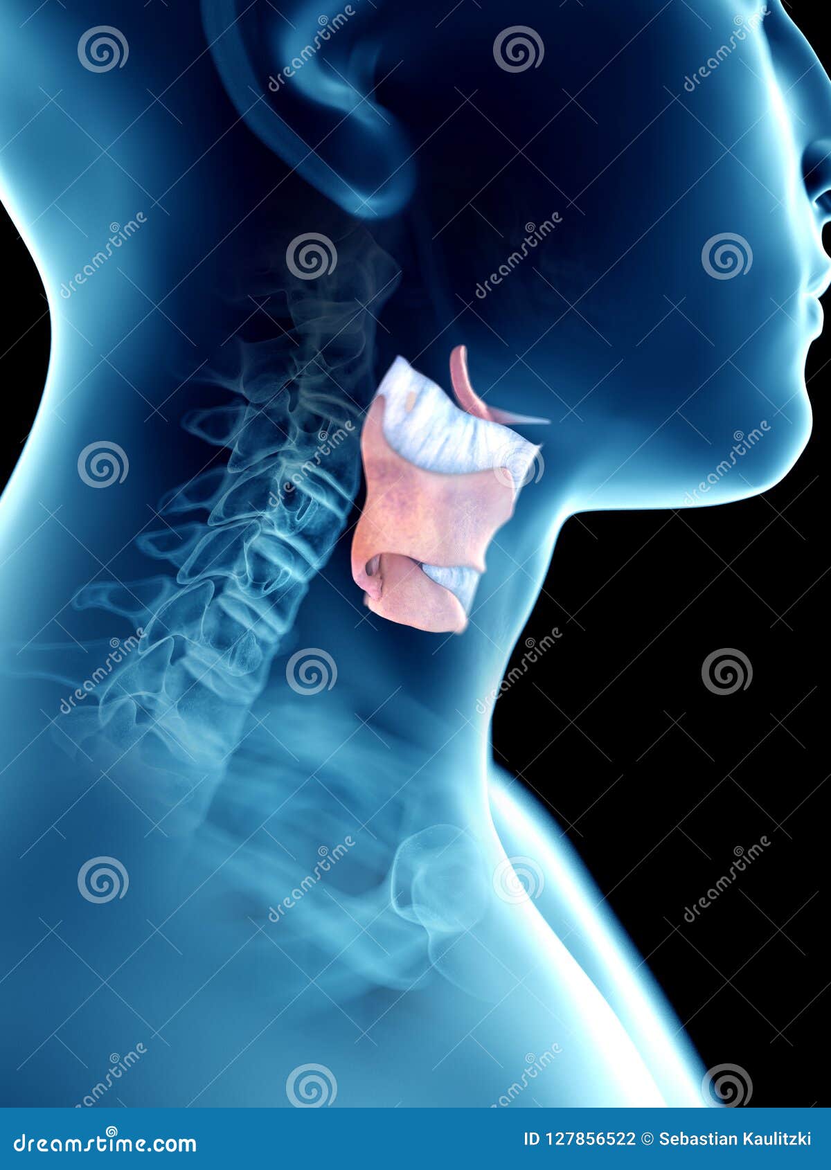 Laryngitis Transparent Icon. Laryngitis Symbol Design From Diseases ...