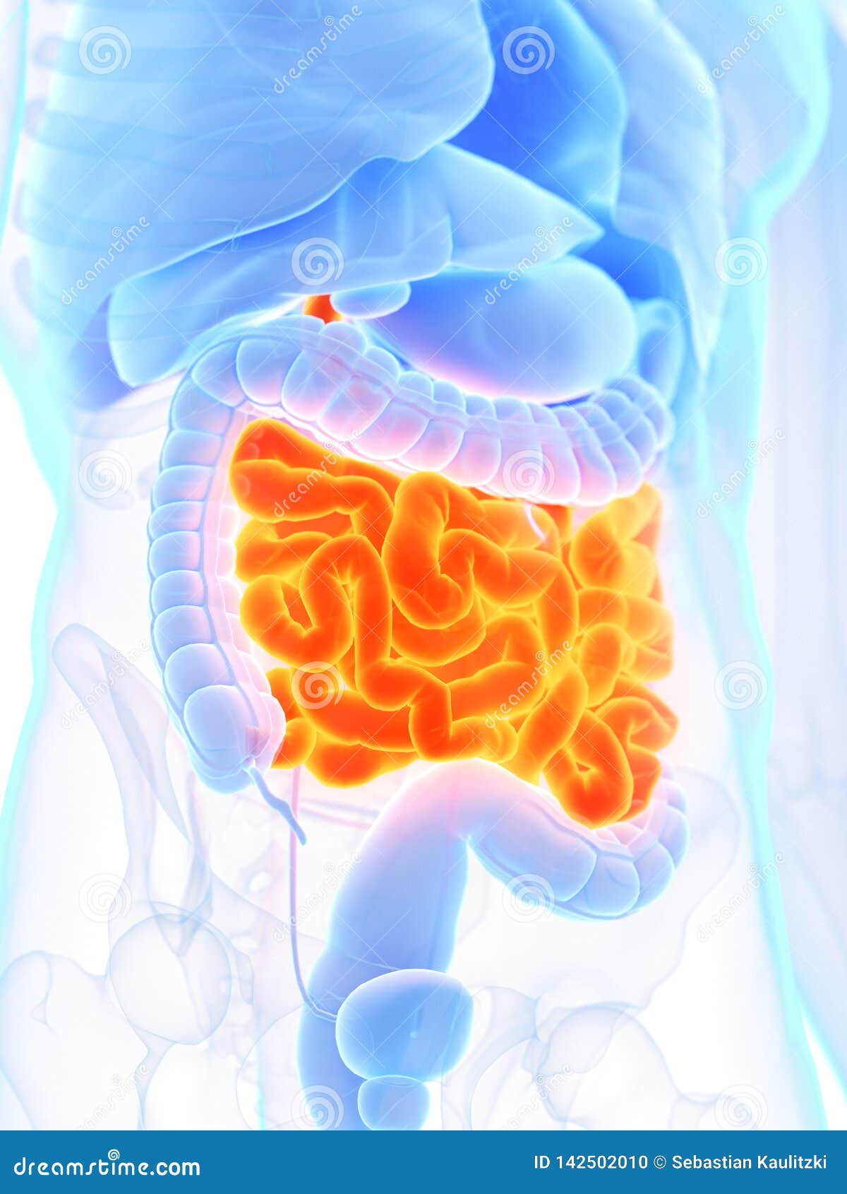 Ulcer In The Intestine. Ulcers In The Colon Vector Illustration ...