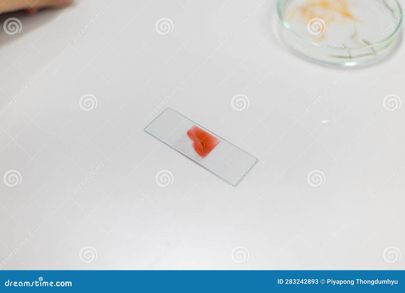 Manual Dissection of Plant Tissue Samples for Study. Stock Image ...