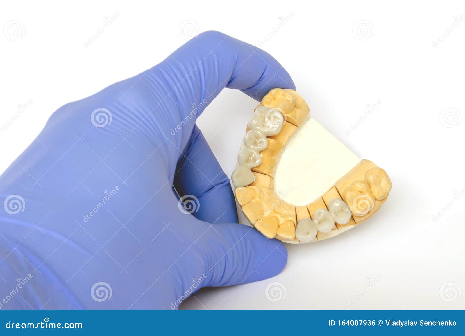 Manufacture of Cermet Teeth. Making False Teeth. Ceramic Teeth Stock ...