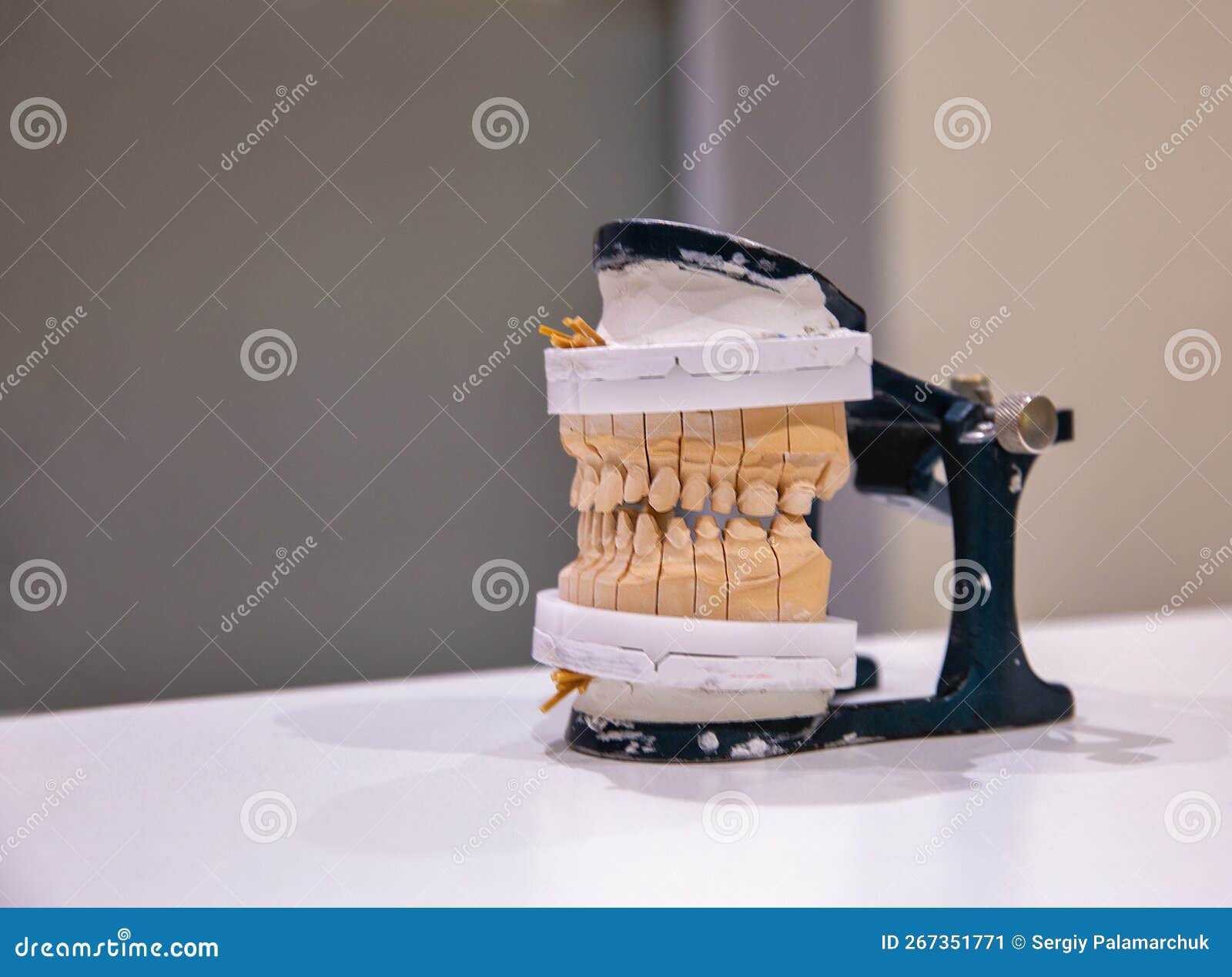 Manufacturing of a Human Permanent Ceramic-metal Dental Prosthesis on ...