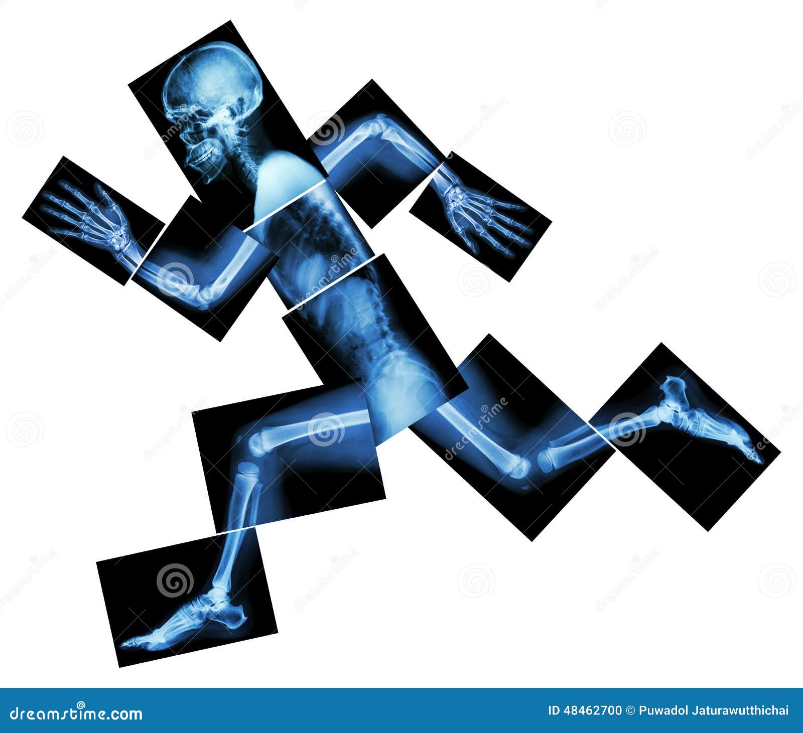Marathon (human Bone is Running) Stock Photo - Image of doctor, athlete ...