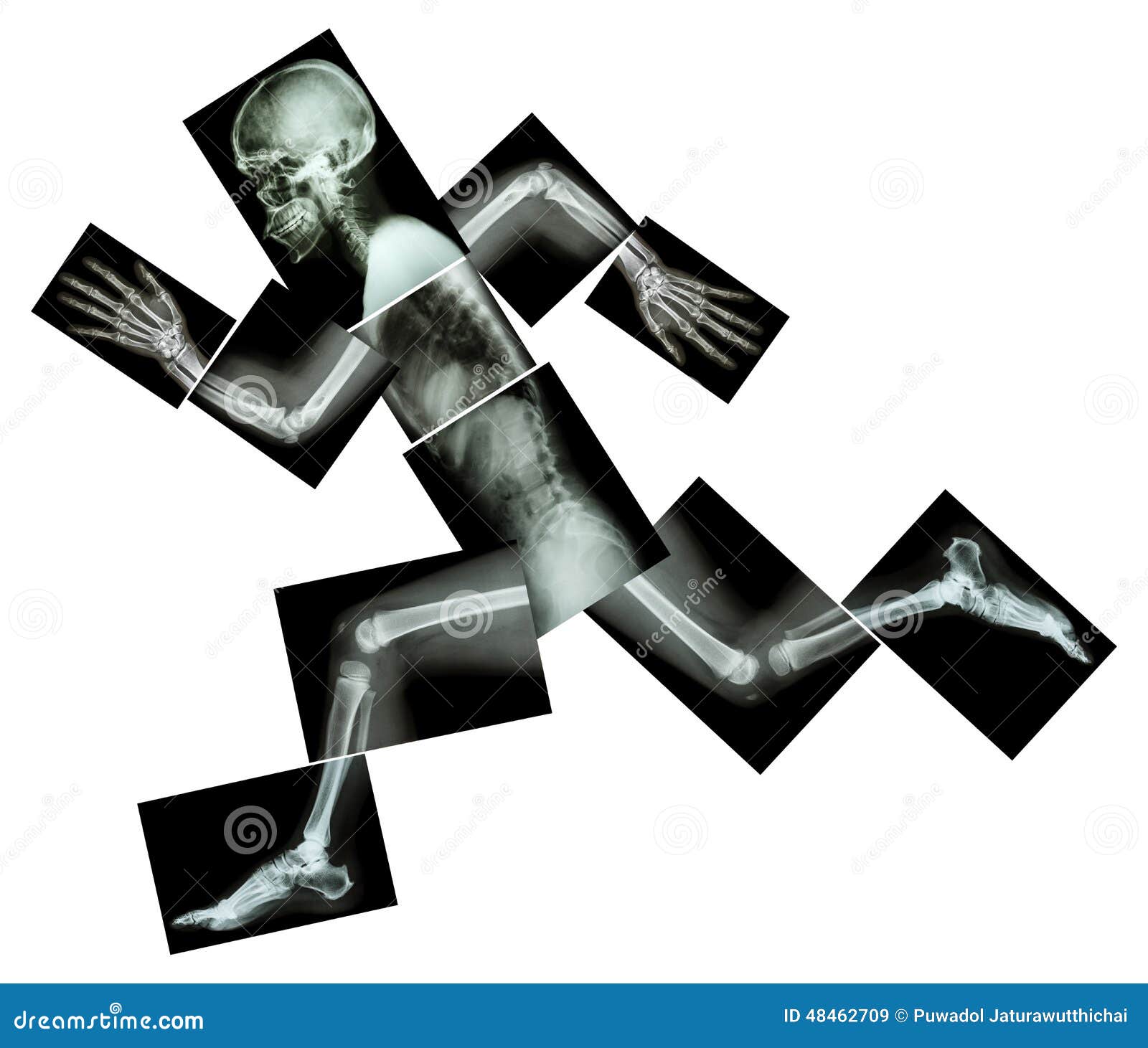 Marathon (human Bone is Running) ,(Whole Body X-ray) Stock Image ...
