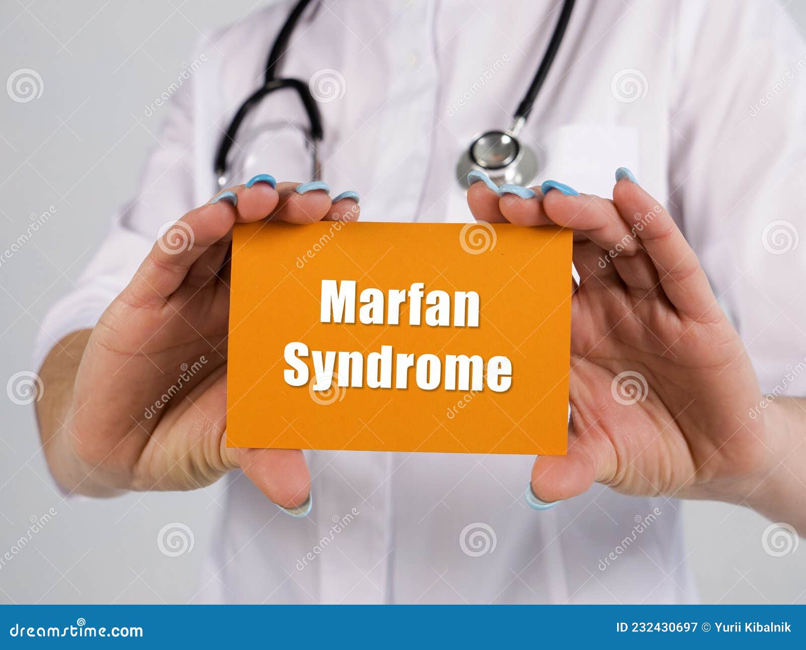 Marfan Syndrome Sign on the Sheet Stock Image - Image of dose, care ...