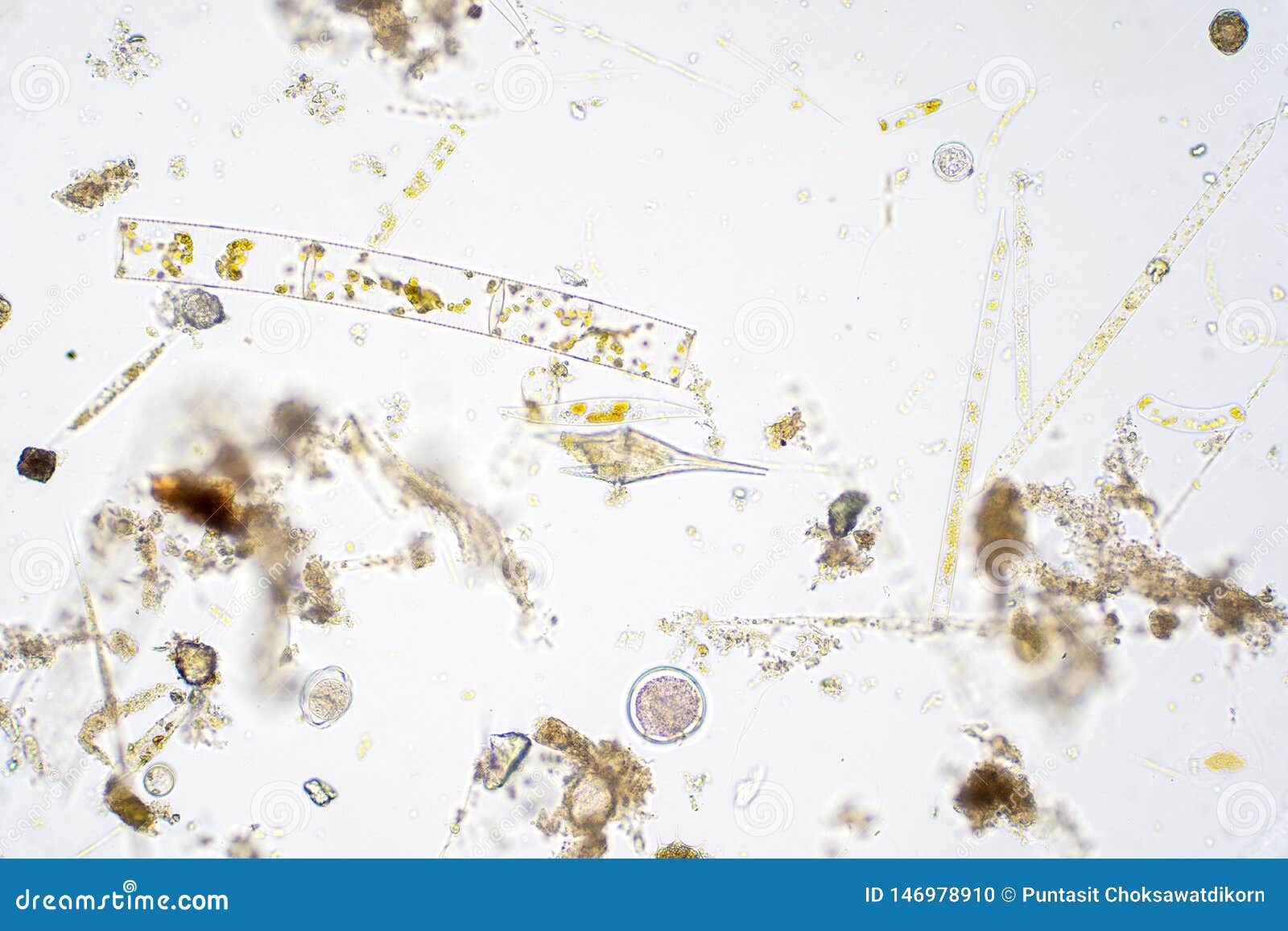 Marine Aquatic Plankton Under Microscope View Royalty-Free Stock Photo ...