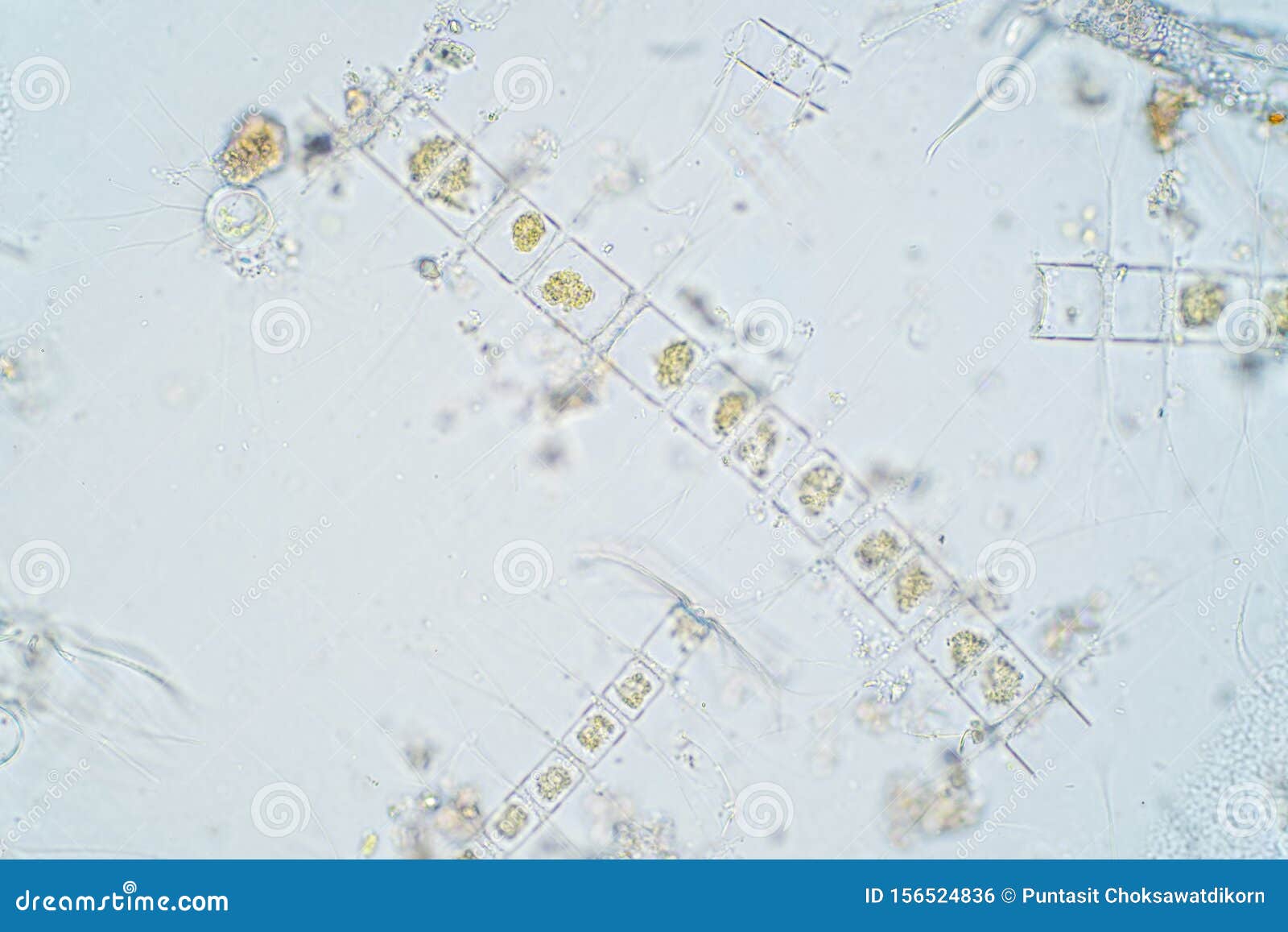 Marine Aquatic Plankton Under Microscope View Stock Photo - Image of ...