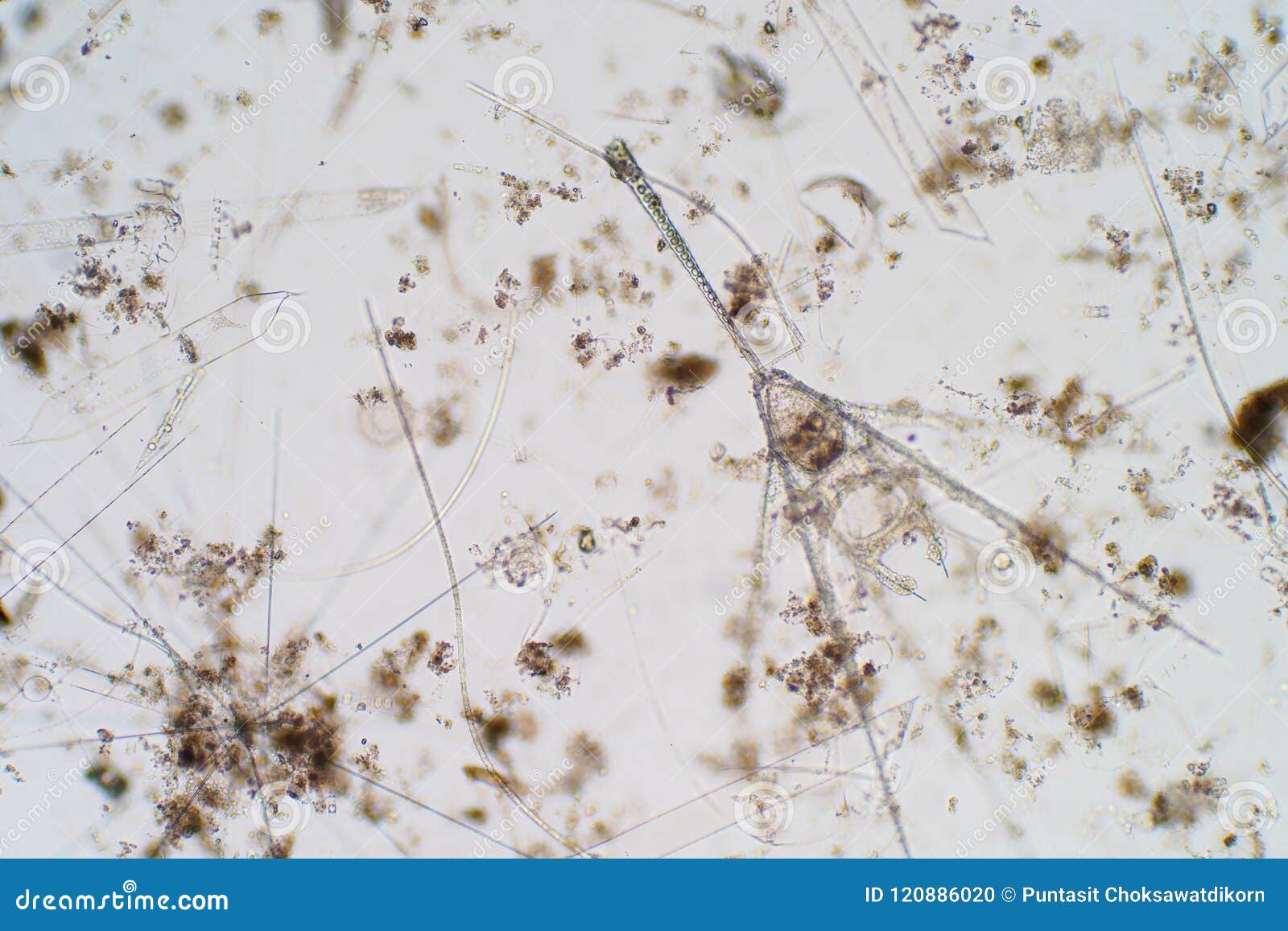 Marine Aquatic Plankton Under the Microscope View Stock Photo - Image ...