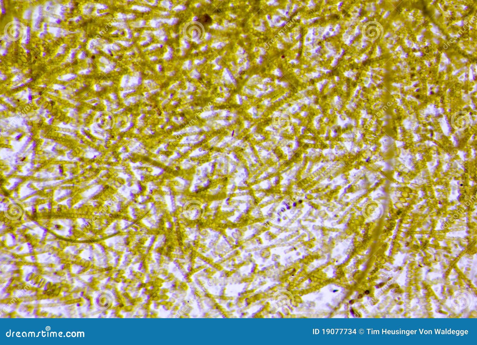 Microalgae Under Microscopic View, Green Algae, Cyanobacteria ...