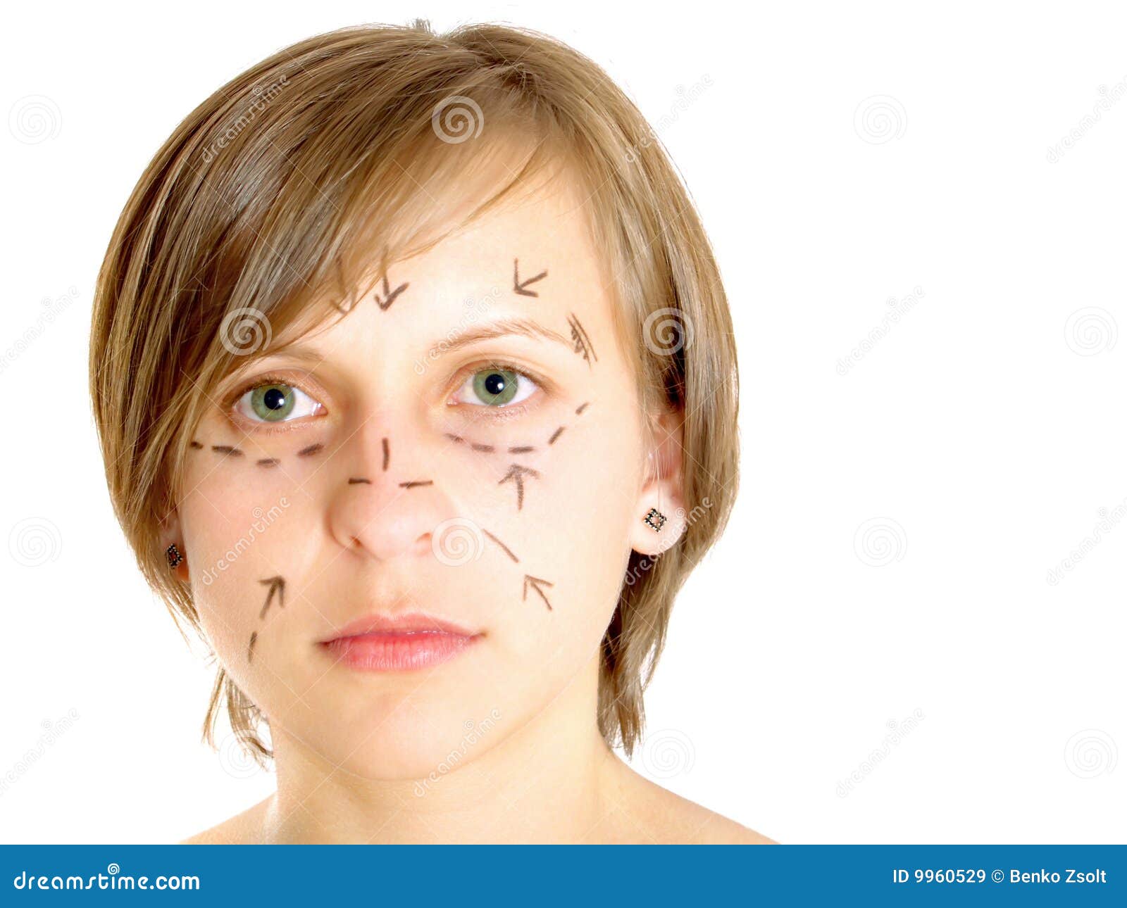 Marked Face for Plastic Surgery Stock Image - Image of beauty ...