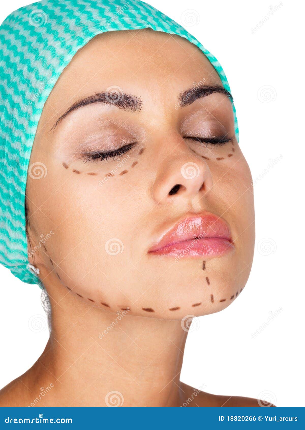 Marking For Cosmetic Plastic Surgery Stock Photo - Image of closeup ...