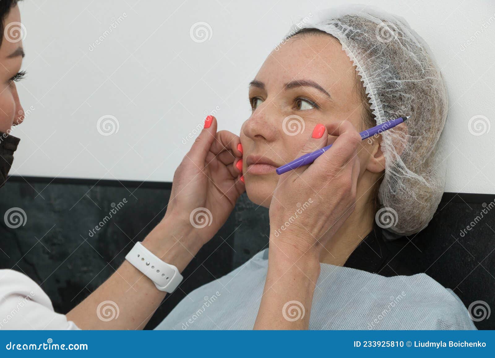 Marking on the Face before the Cosmetic Thread Lifting Procedure Stock ...