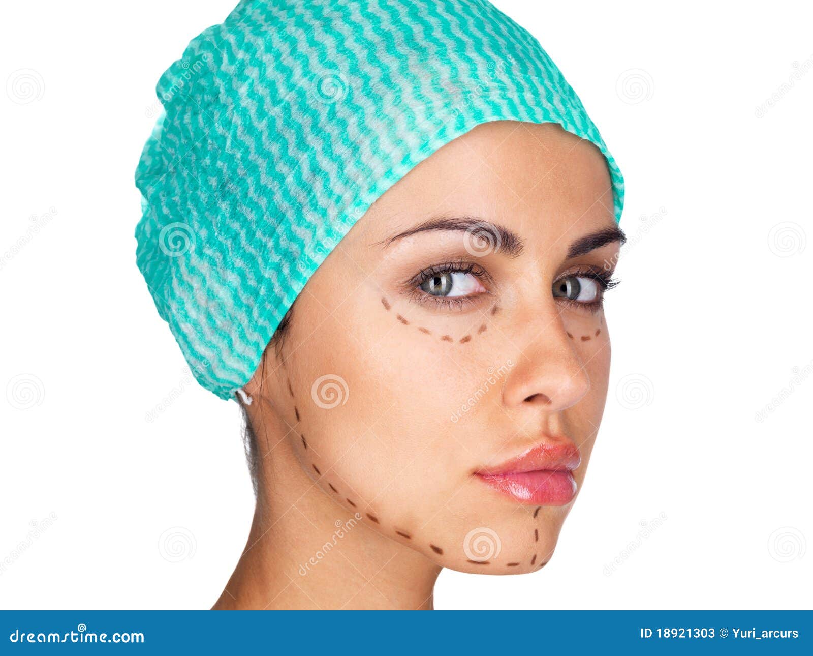 Marks for Facial Plastic Surgery Stock Image - Image of isolated ...