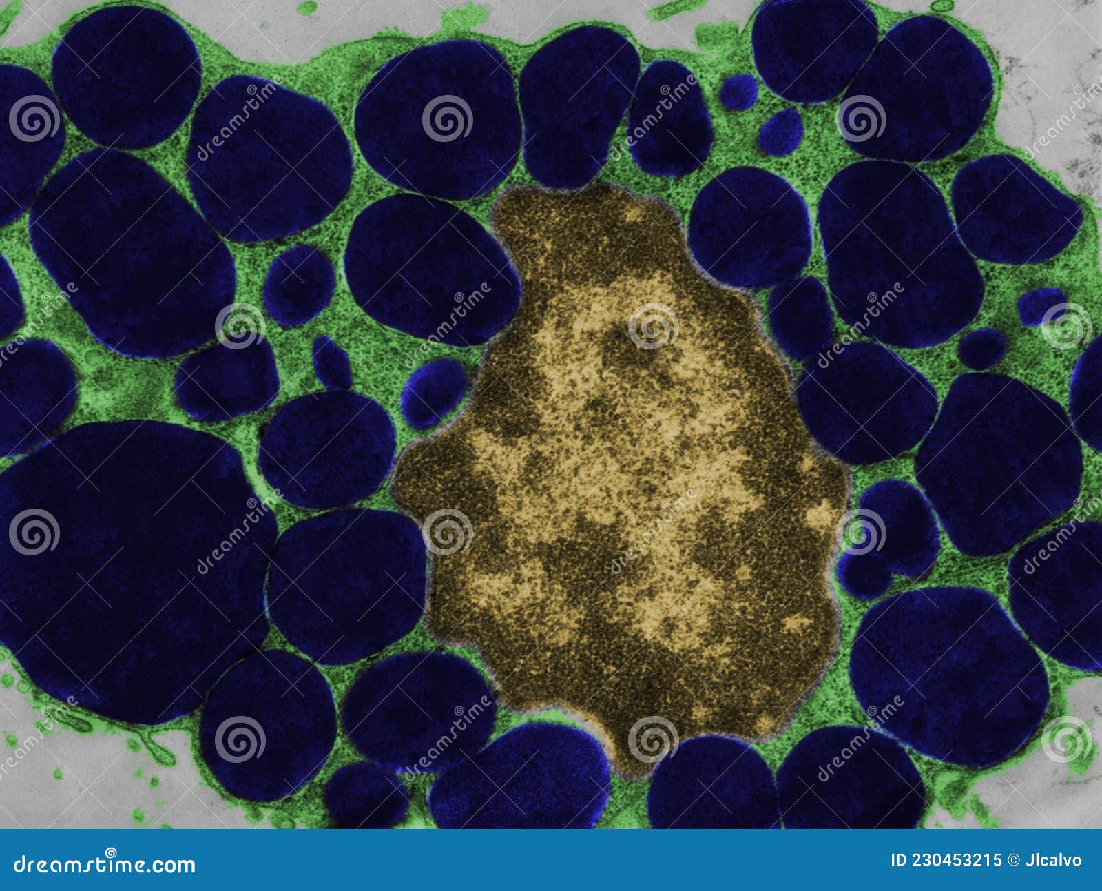 Mast cell granules stock image. Image of cytological - 230453215