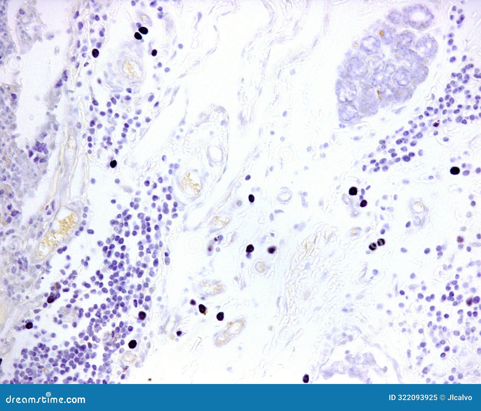 Connective Tissue. Mast Cells Stock Image - Image of mast, histological ...