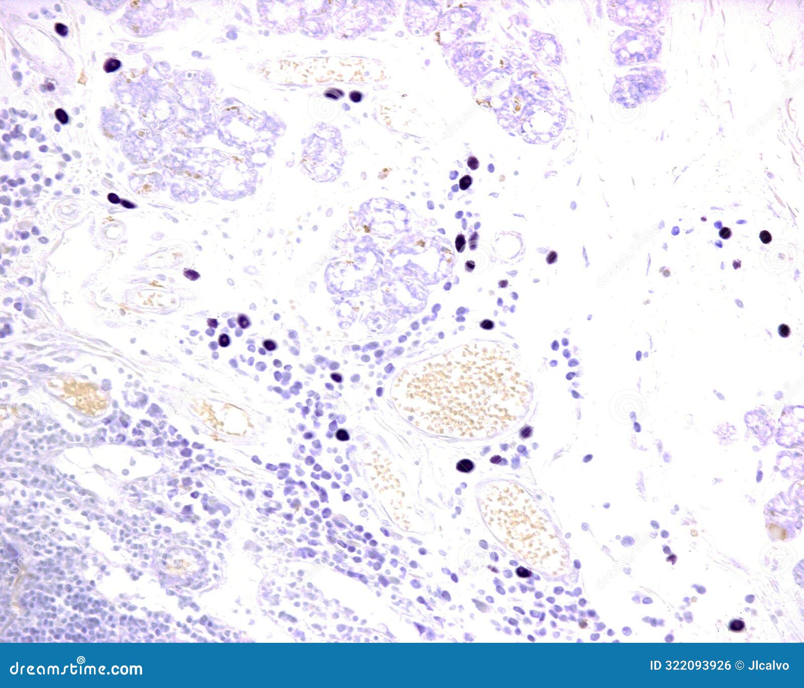 Mast cells stock photo. Image of microscope, histological - 322093926