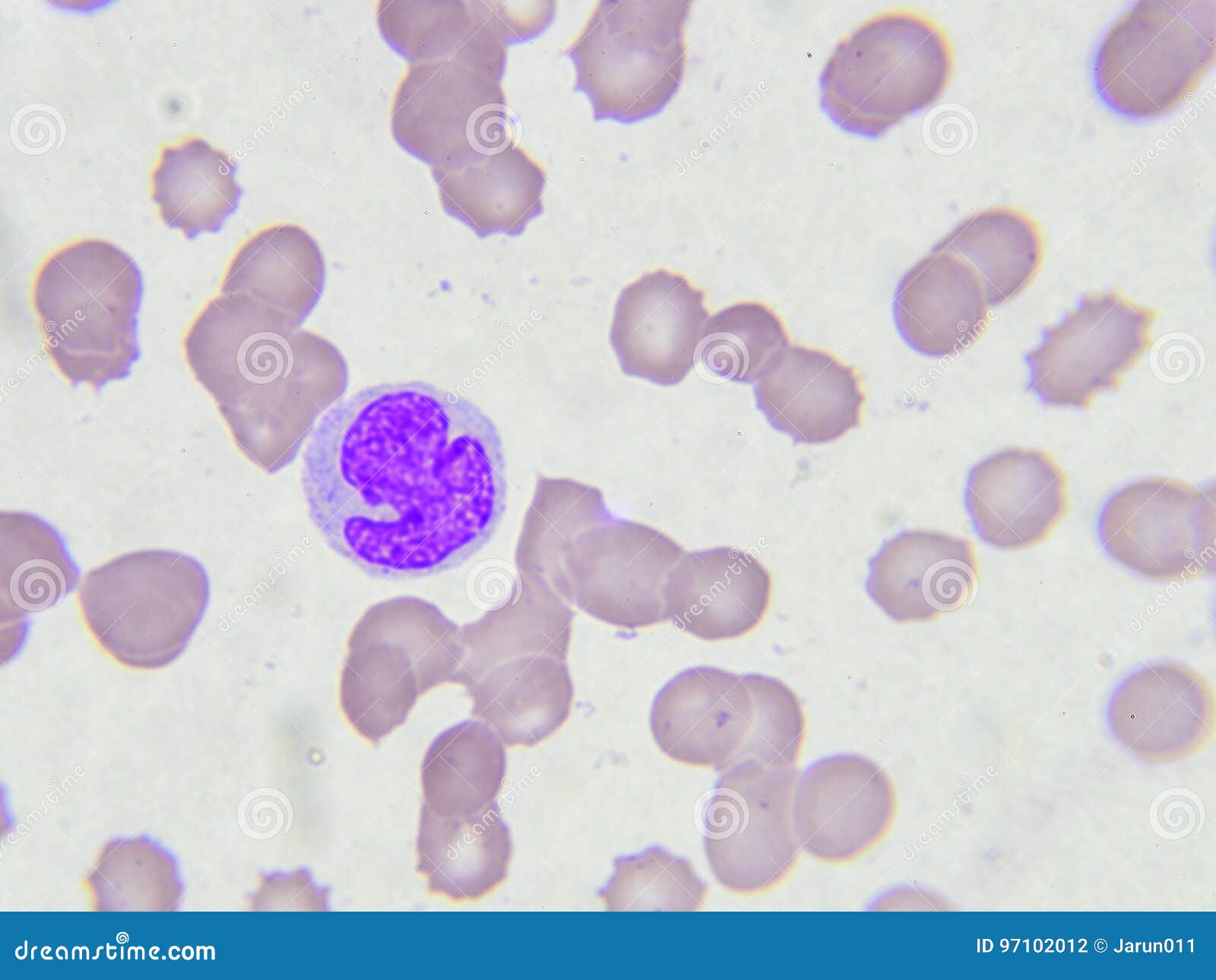 Mastcel of Een Mastocyte, Labrocyte Stock Foto - Image of ziekte ...