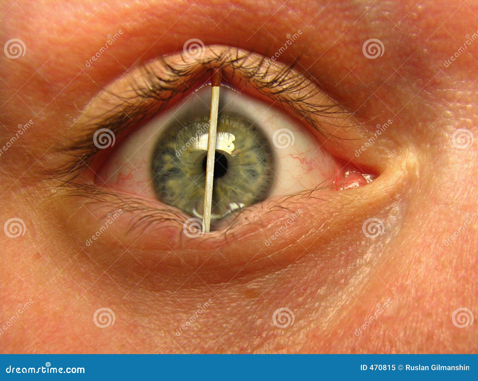 Match in eye. stock illustration. Illustration of match - 470815