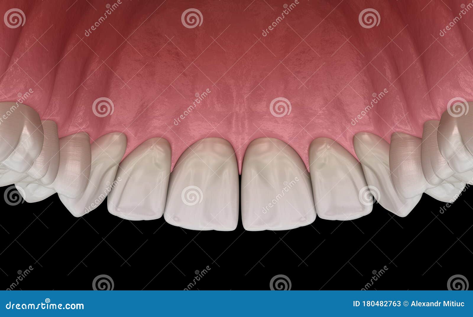 Maxillary Human Gum and Teeth. Medically Accurate Tooth Illustration ...