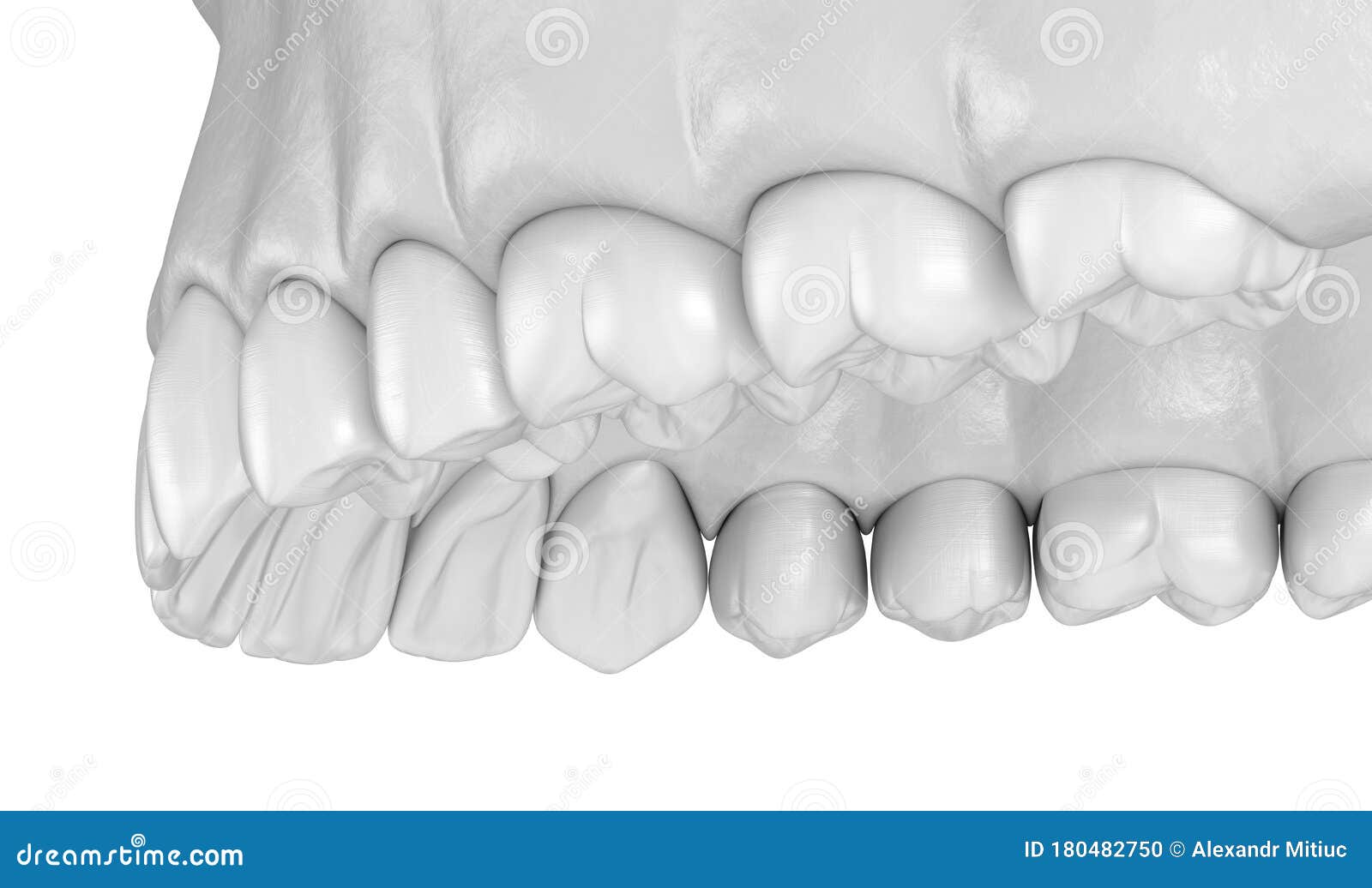 Maxillary Human Gum And Teeth In White Style. Medically Accurate Tooth ...
