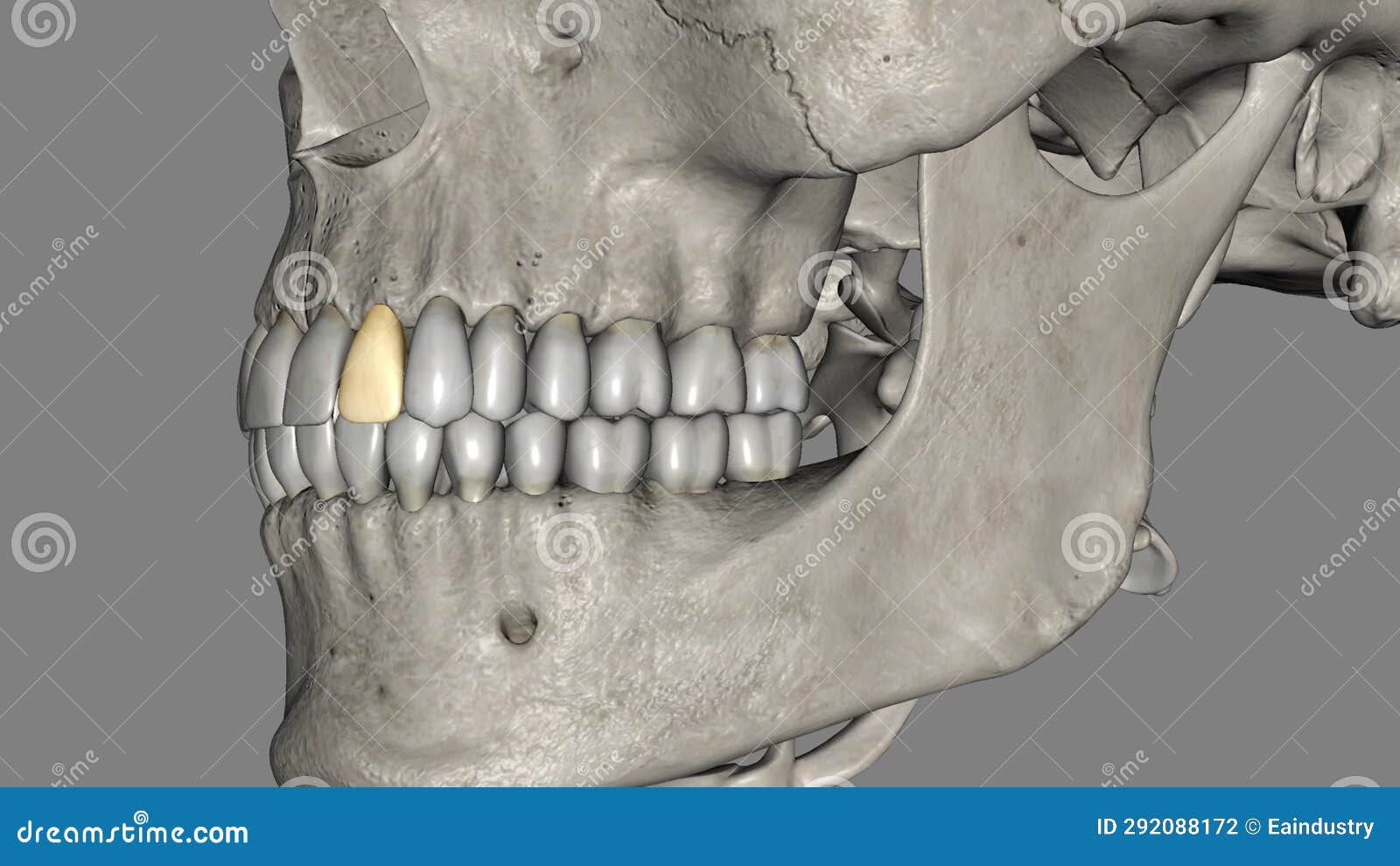 The Maxillary Lateral Incisors are a Pair of Upper (maxillary) Teeth ...