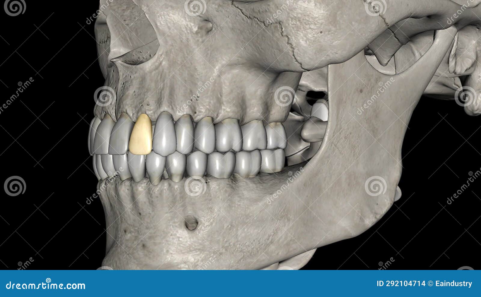 The Maxillary Lateral Incisors are a Pair of Upper (maxillary) Teeth ...