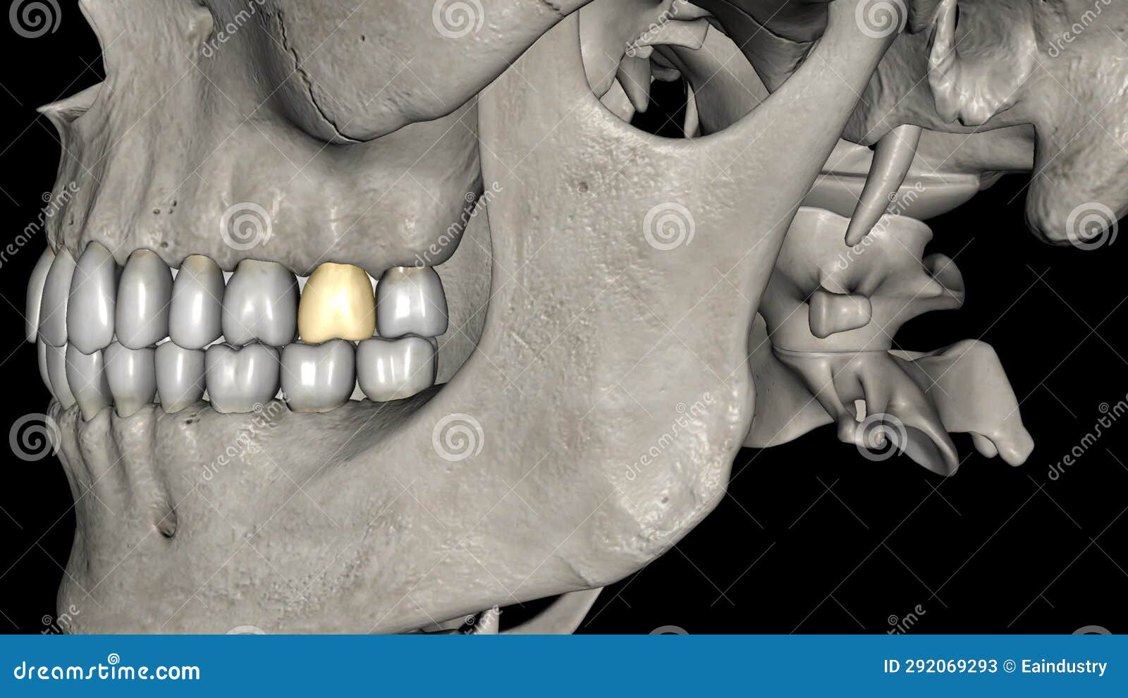 The Maxillary Second Molar is the Tooth Located Distally from Both the ...