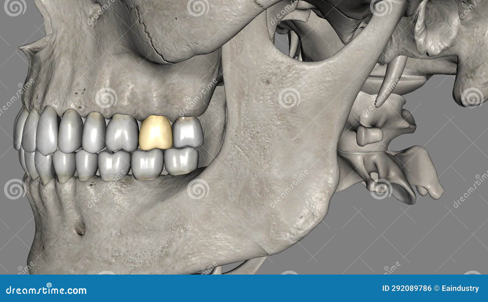 The Maxillary Second Molar is the Tooth Located Distally from Both the ...