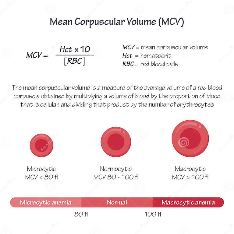 Mean Corpuscular Volume MCV Medical Vector Illustration Graphic Stock ...