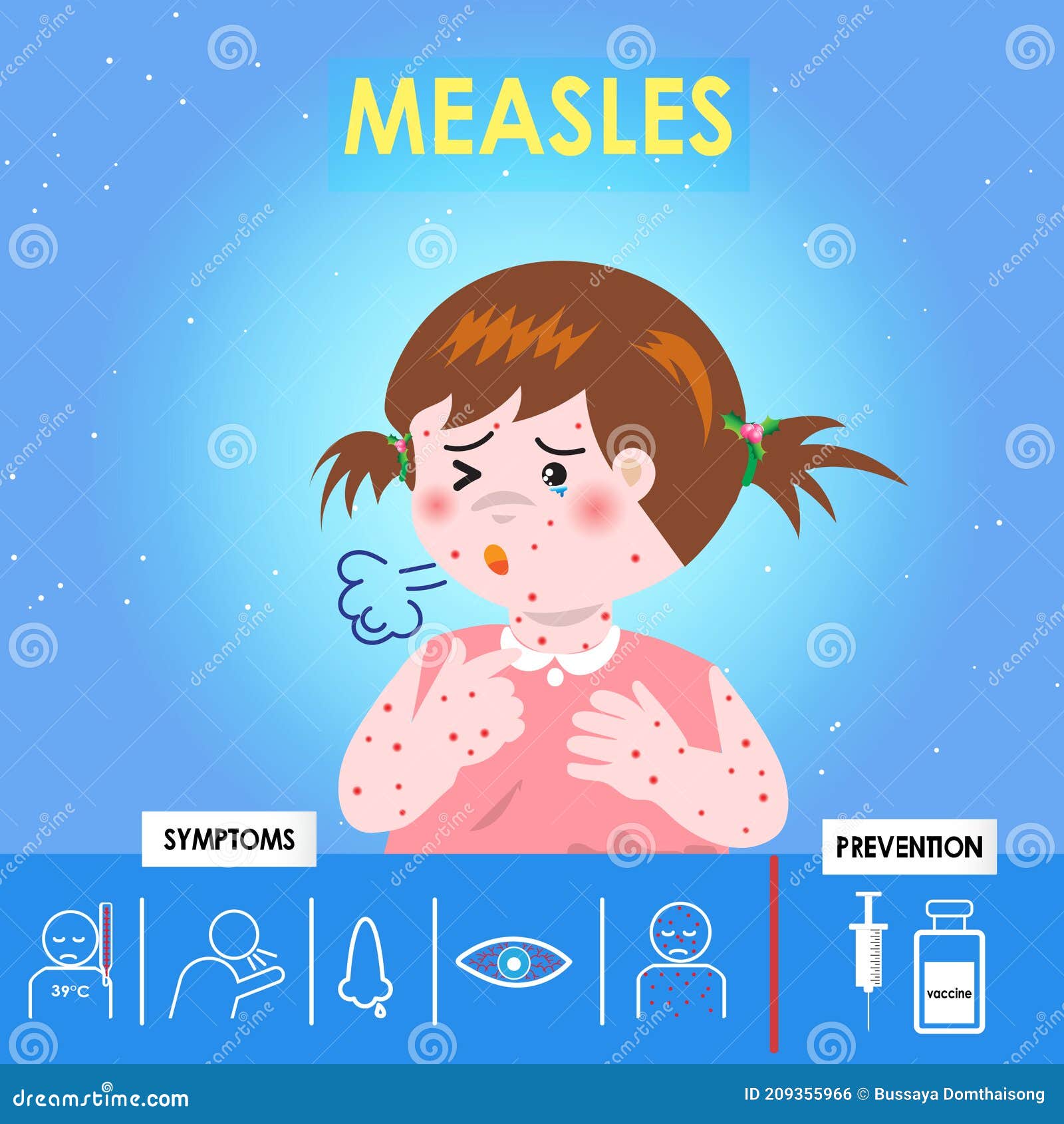 Infographics of Measles. Kid Girl Pneumonia with Cough and Red Skin ...