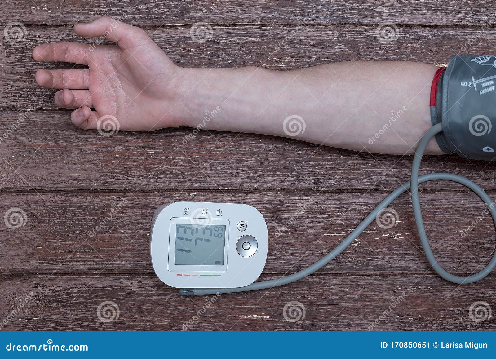 Measurement of Blood Pressure in the Hand, Performed Using a Classic ...