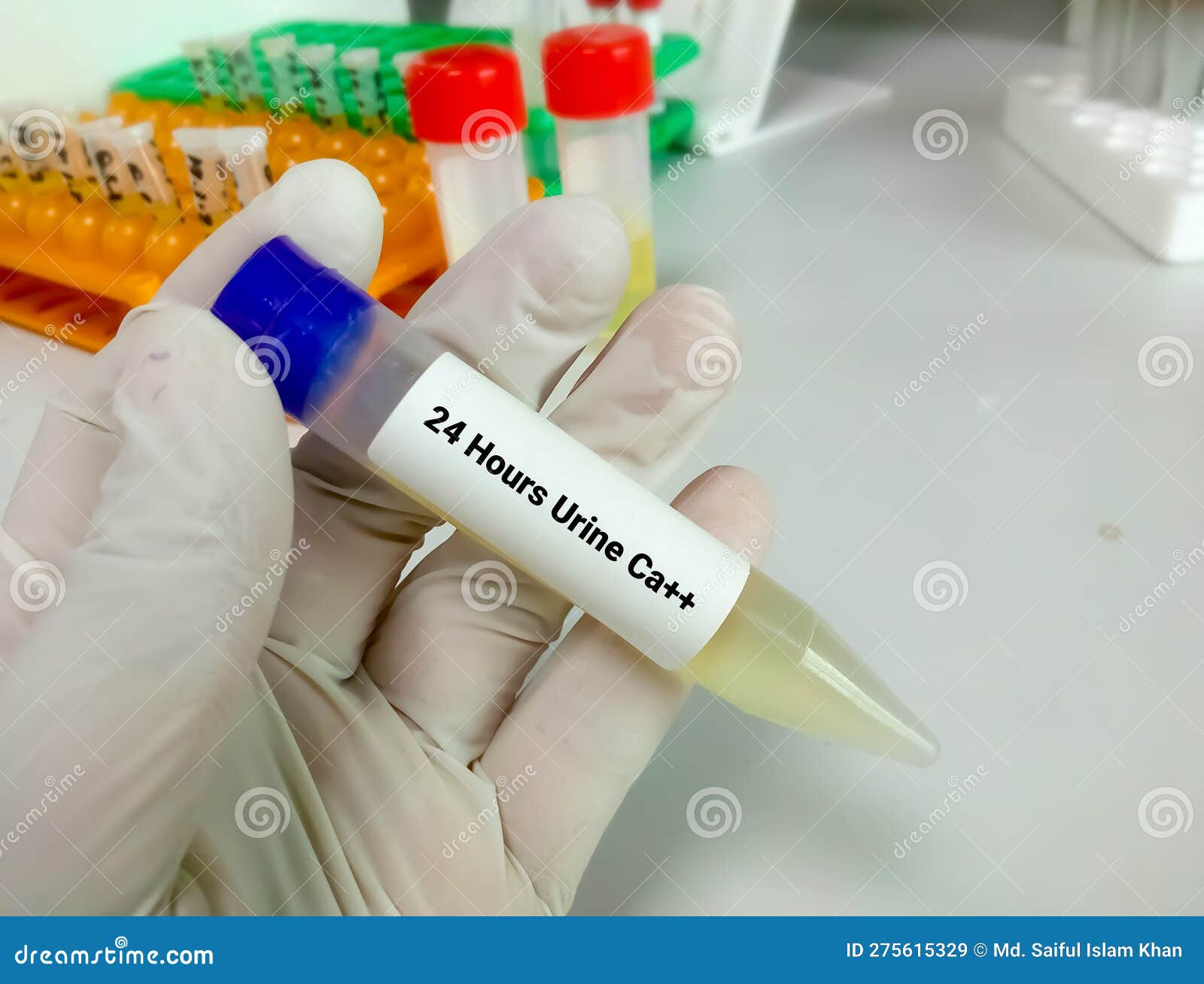 Measurement of the Concentration of 24 Hours Urine Calcium. Stock Image ...