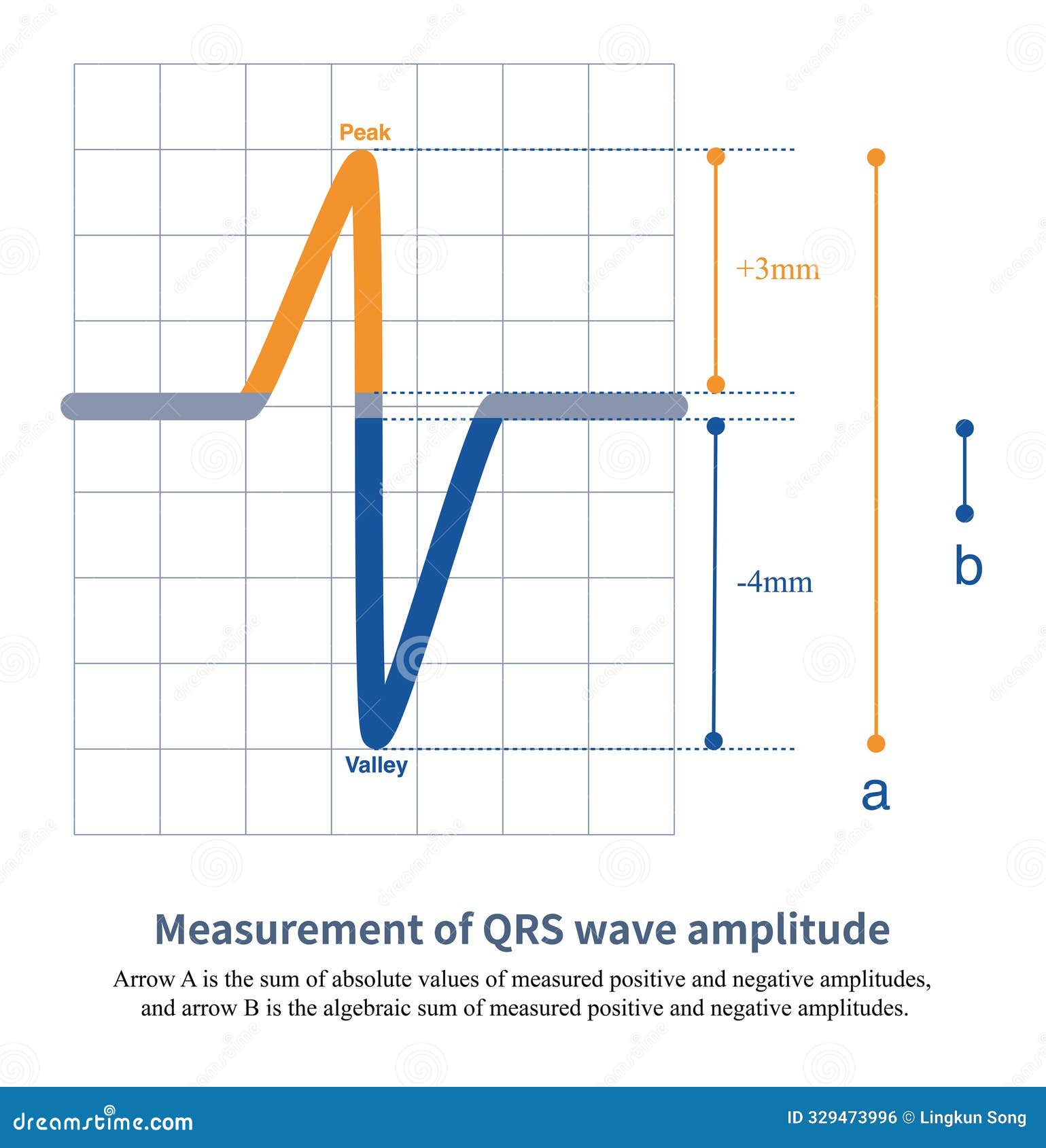 Qrs Cartoons, Illustrations & Vector Stock Images - 137 Pictures to ...