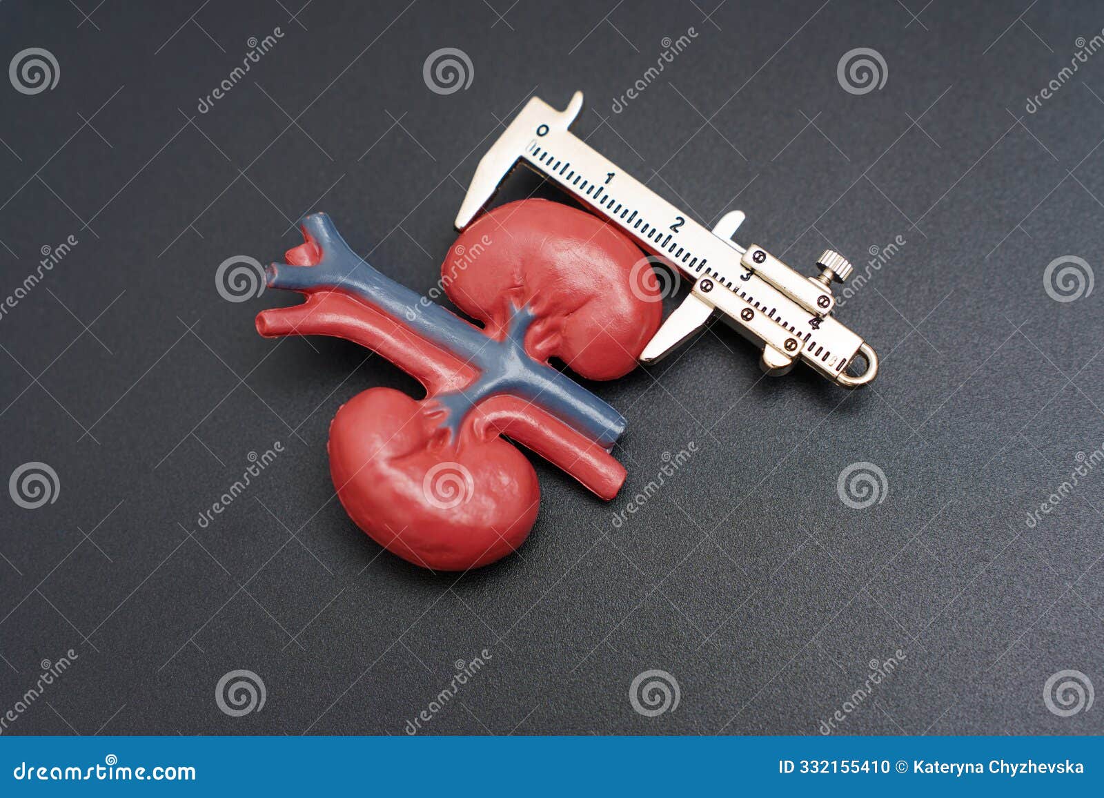 Measuring Kidney Model with Caliper Tool in Educational Context Stock ...