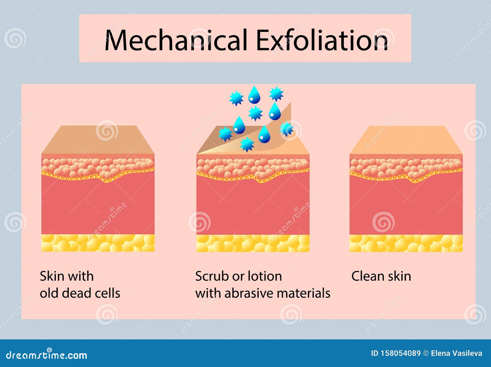Mechanical Exfoliation Or Peeling, Vector Illustration On Light ...