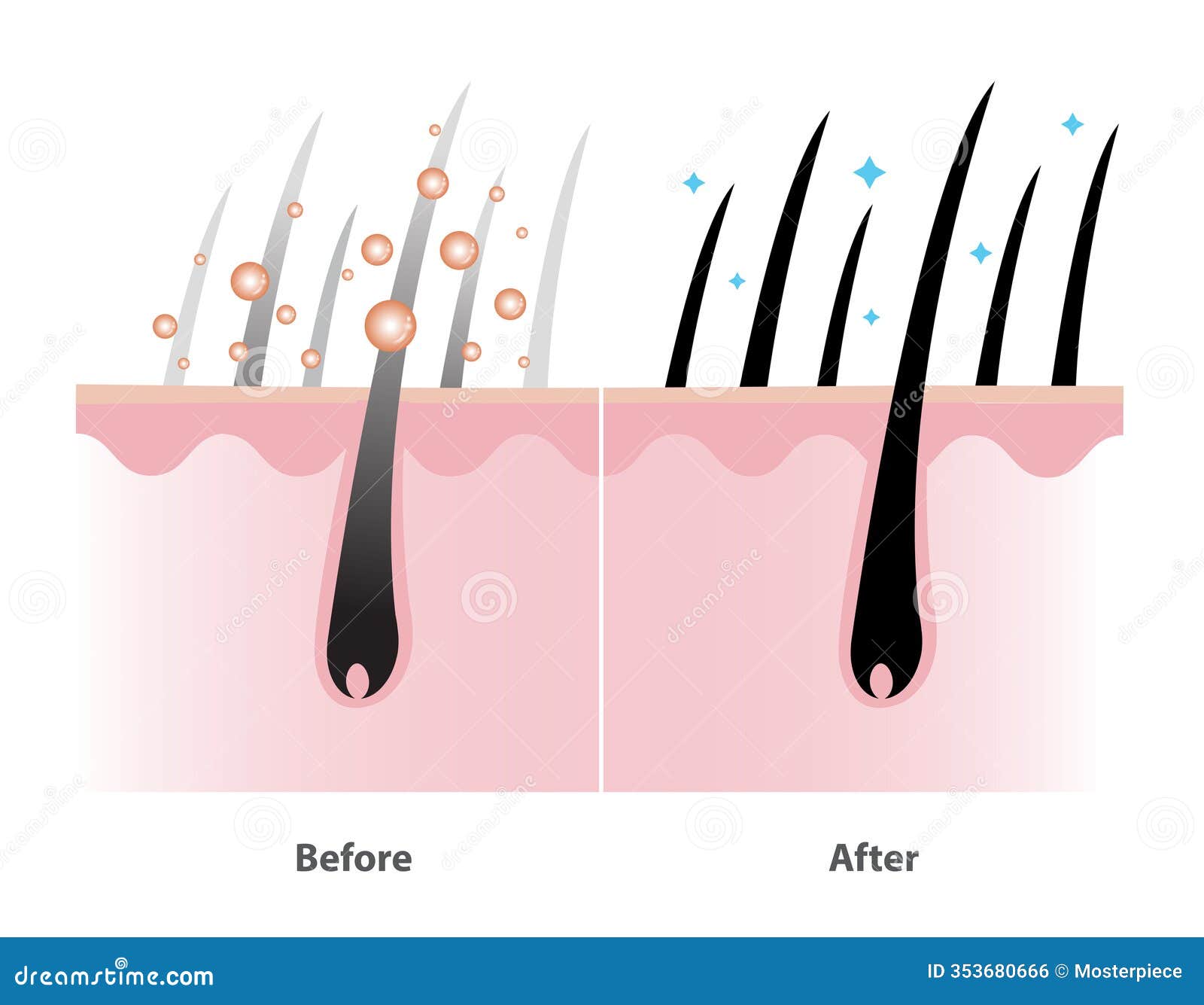 Scalp Shampoo Foam Cartoon Vector Illustration | CartoonDealer.com ...
