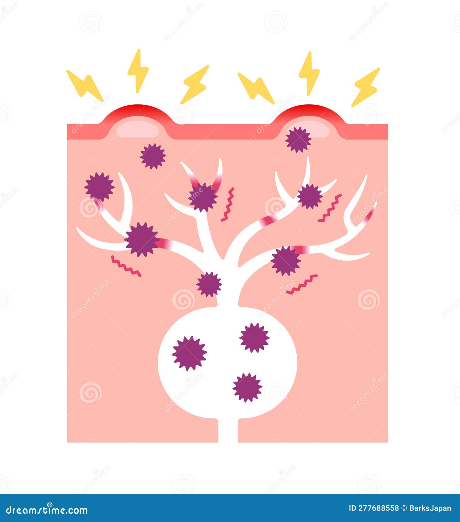Herpes Zoster Line Outline Icon Vector Illustration | CartoonDealer.com ...