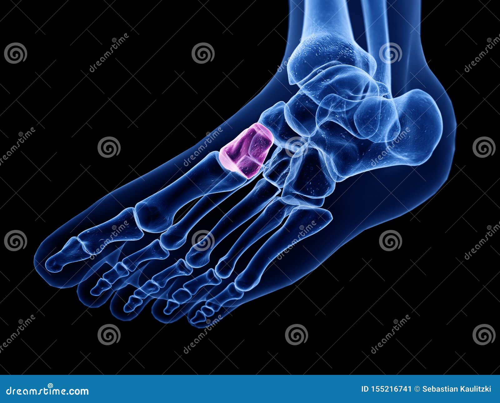 The medial cuneiform bone stock illustration. Illustration of artwork ...