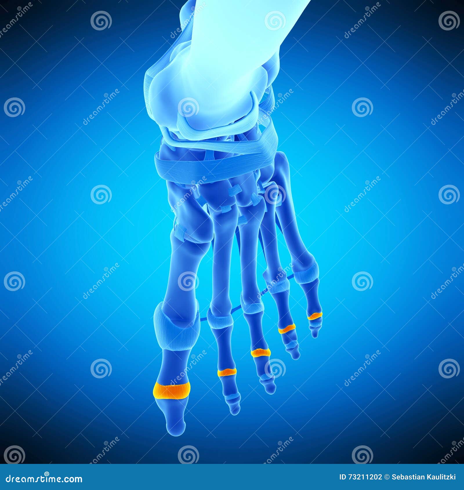 Medial Ankle Injury_Tibialis Anterior Tendonitis Cartoon Vector ...